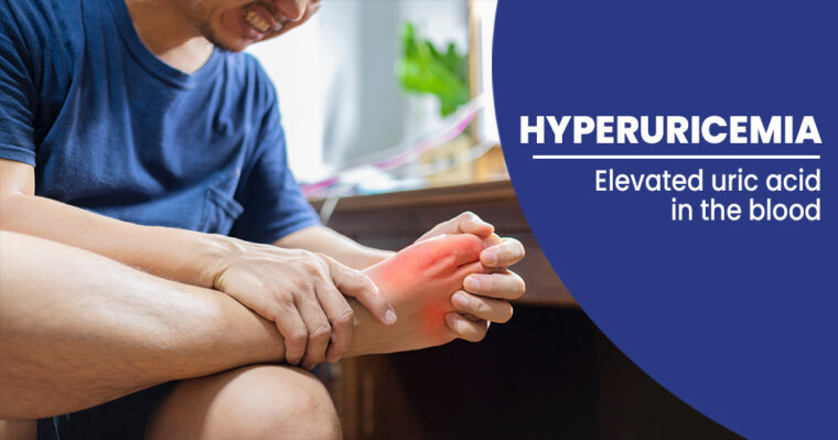 What is Hyperuricemia? - FAQs
