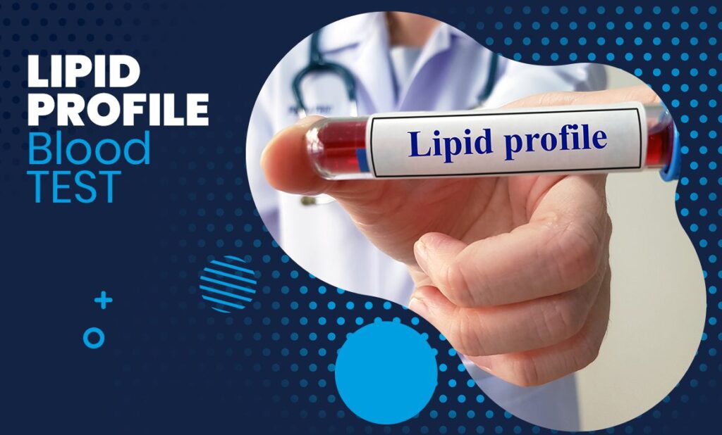 What Is a LIPID PROFILE Test? - FAQs