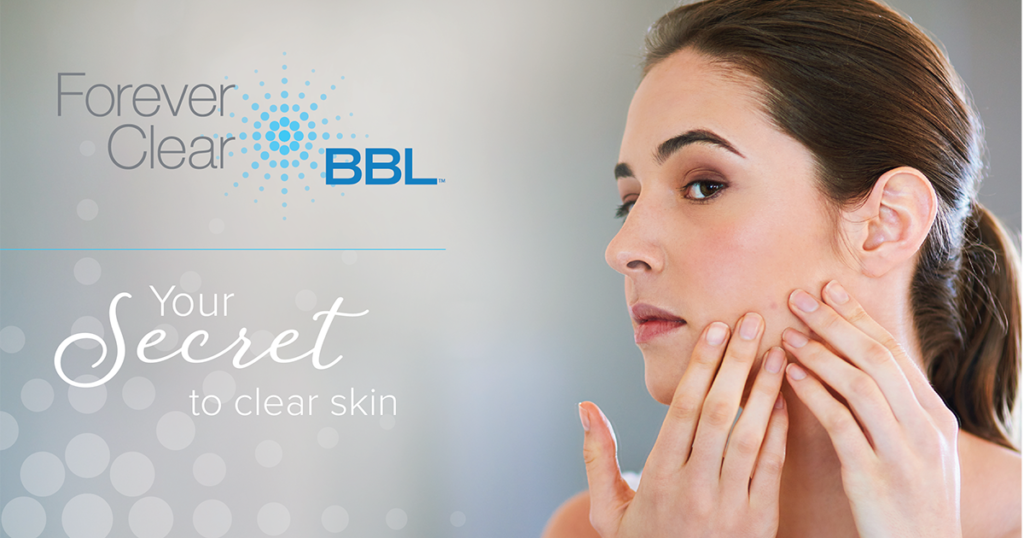 Forever Clear BBL Acne Treatment - FAQs